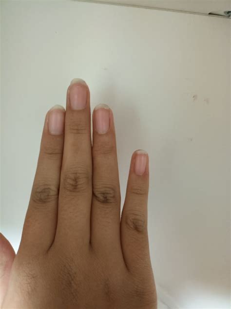 새끼손가락 휨 지식in