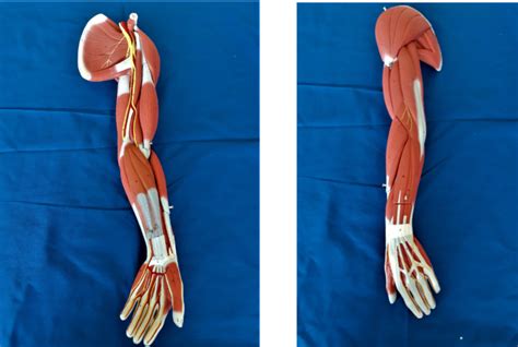Diagram Of Ant And Post Arm Quizlet