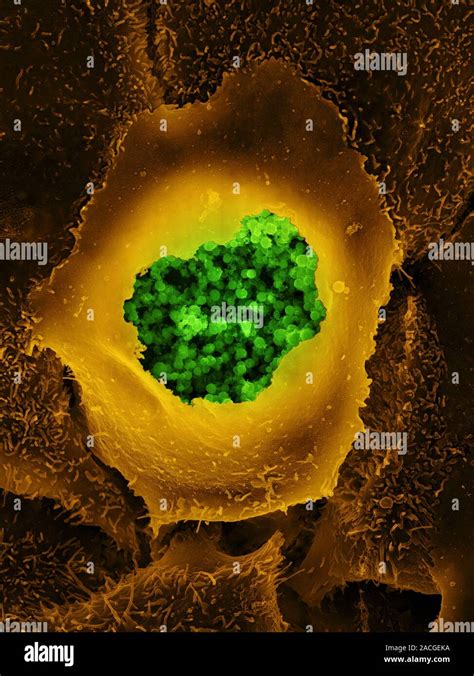 Chlamydia Coloured Scanning Electron Micrograph Sem Of Chlamydia