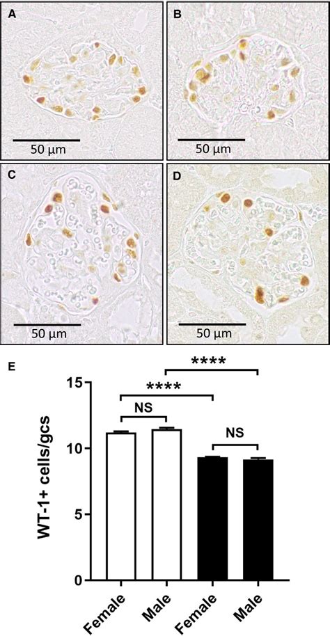 Effect Of Sex On Podocyte Loss In Diabetic Nos3‐ ‐ Mice Immunostaining Download Scientific