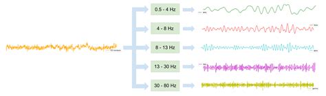 Eeg Preprocessing Filters At Jennifer Shields Blog