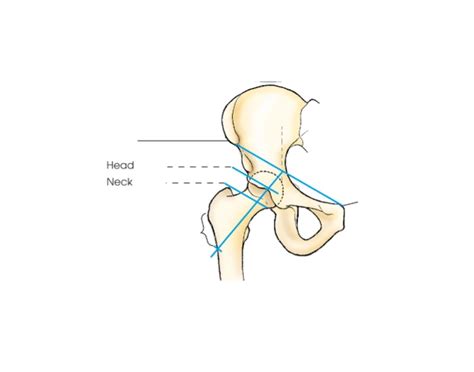 hip joint localization — printable worksheet