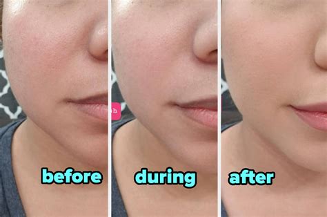 Yes Its True These 22 Korean Skincare Products Are Really Worth