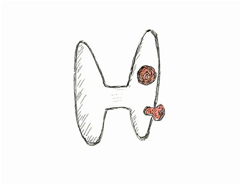 Thyroid Cancer Incidence And Mortality Are Up Gt Health