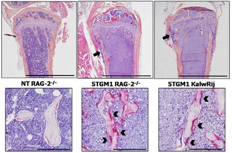 Figure 3 From A Murine Model Of Myeloma That Allows Genetic Manipulation Of The Host