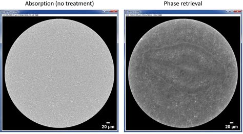 Computed Tomography Improved X Ray Imaging Using Phase Retrieval