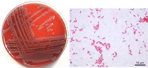 Bms 535 Medical Microbiology Lab Practicum Part 2 And