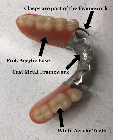 Partial Castacrylic Dentures Flippers And Custom Options Grantham