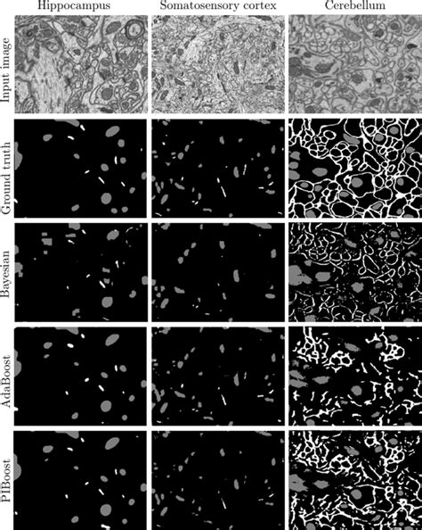 Multi Class Segmentation Of Neuronal Structures In Electron Microscopy Images Bmc