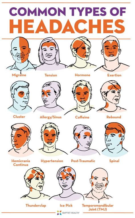 Common Types Of Headaches Baptist Health Headache Types Headache Sinusitis