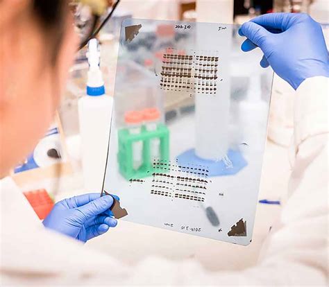 How Do You Choose The Right Western Blot Detection Method Enzo