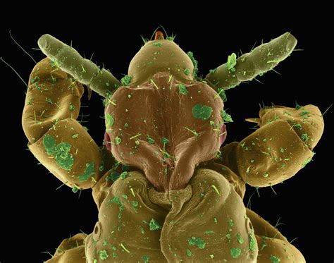 Head Louse Photograph By Dennis Kunkel Microscopyscience Photo Library Fine Art America
