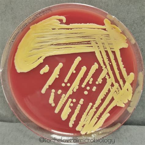 Staphylococcus Sciuri On A Fortheloveofmicrobiology Facebook