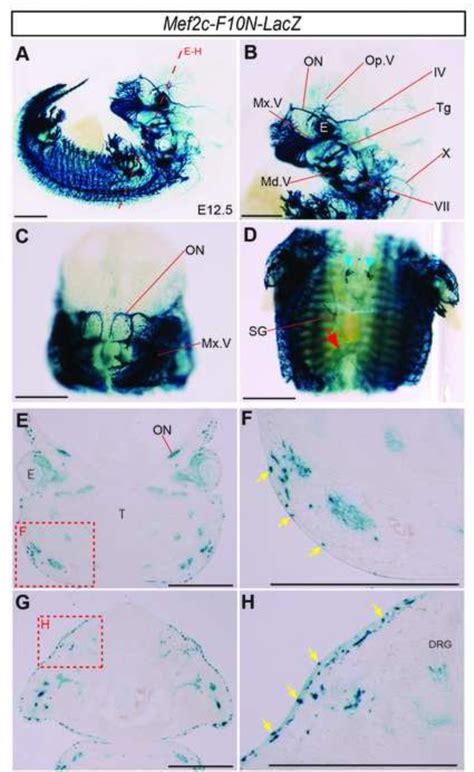 Mef2c F10n Lacz Expression Pattern Corresponds To Pns And Melanocyte Download Scientific