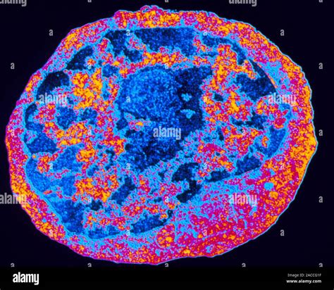 Streptococcus Lactis