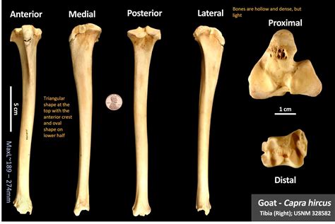 Tibia Anterior Crest