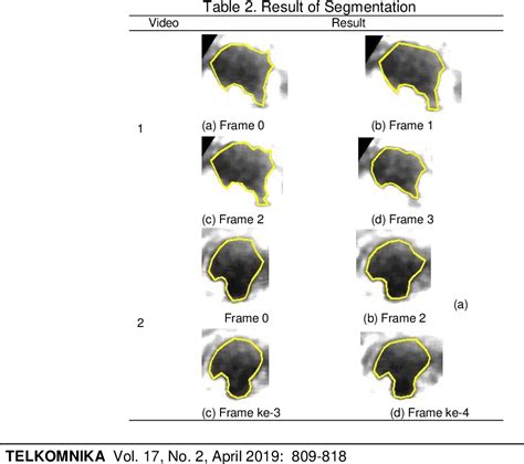 Table 2 From Improved Echocardiography Segmentation Using Active Shape Model And Optical Flow