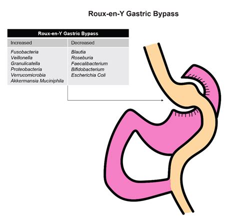 Cs Cz Bypass Cd Key Lovesany