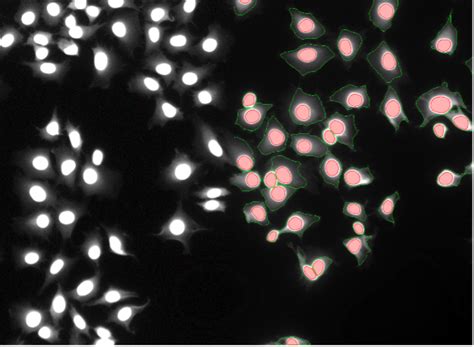 20 Examples Of Effortless Nucleus And Cell Segmentation Using Pretrained Deep Learning Models