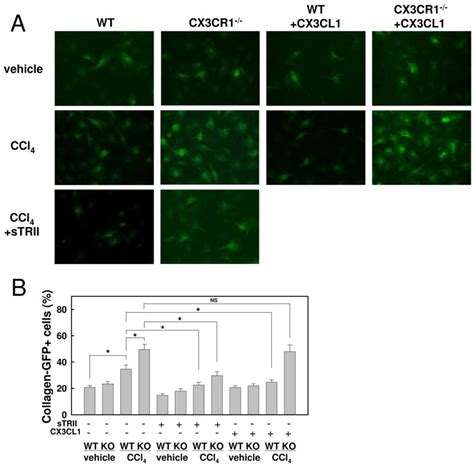 Cx3cl1 Cx3cr1 Interaction Prevents Ccl4 Induced Liver Inflammation And Fibrosis Pmc
