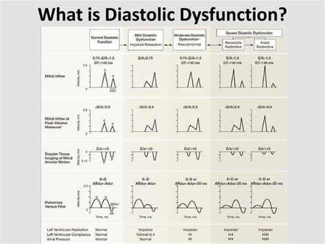 Ppt Diastolic Dysfunction As Diagnosed And Quantified By