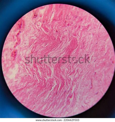 Photo Adipose Tissue Under Microscope Stock Photo Shutterstock