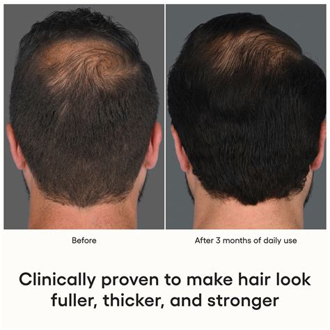Shop Hair Serum Today Exosome Hair Care Products Plated ™ Skin