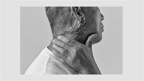 바비톡 화상 입은 소방관 위한 ‘히어로 패턴 캠페인 실시