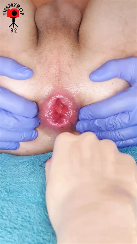 Fisting A Twink Xhamster