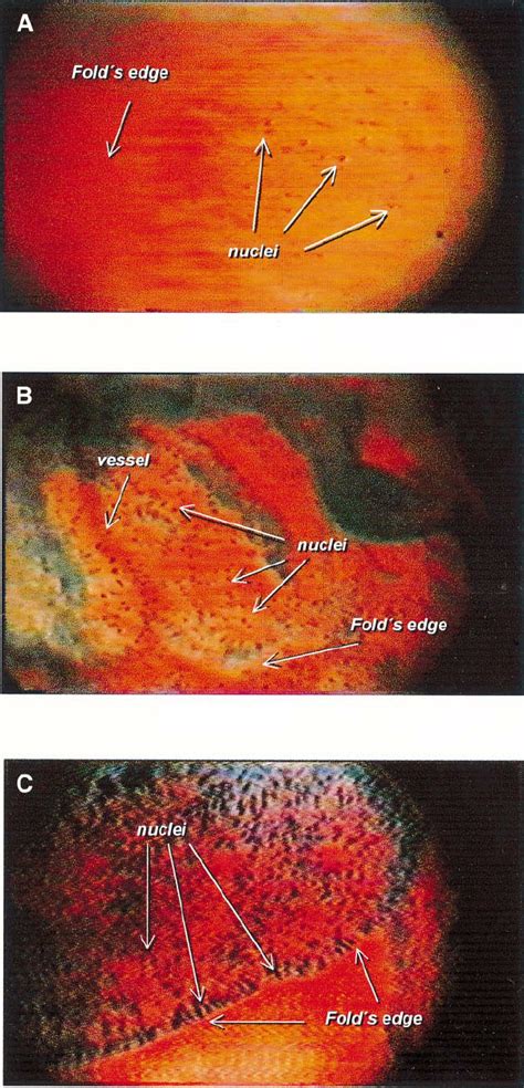 Nuclear Staining A Isolated Nuclei B Moderate Concentration Download Scientific