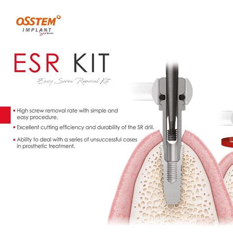 Osstem Serbia Esrkit Esr Kit Osstemserbia Osstem Facebook