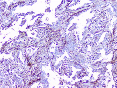 Collagen Iii Antibody Pa5 95595