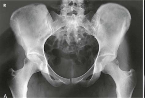 IA Test Pelvic Positioning Flashcards Quizlet