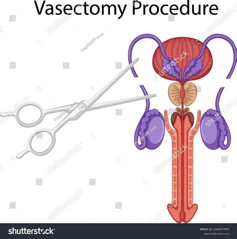 Inside Male Reproductive System Illustration Stock Vector Royalty Free