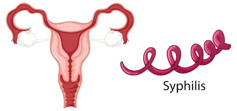 Syphilis Bacteria Diagram