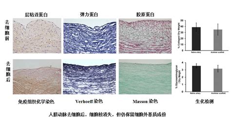 我校病理生物学教育部重点实验室在组织工程小口径血管移植物研究上取得新进展 吉林大学基础医学院
