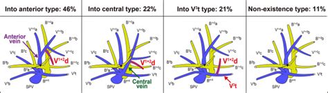 Segmentectomy Oriented Anatomical Model For Enhanced Precision Surgery Of The Left Upper Lobe