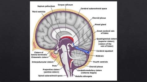 Cerebral Cisterns For Radiology Dnb Pptx