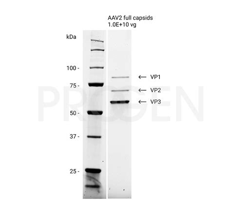 Aav2 Standard Material Egfp 66v021