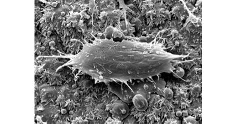 implant surfaces llc and cmdc labs agree to a joint effort developing