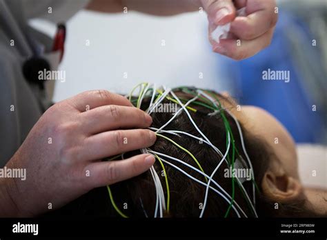 Neurology Screening And Monitoring Of Epilepsy Placement Of