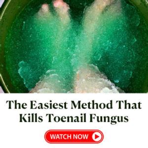 Baking Soda For Toenail Fungus Effective Home Remedy Tips