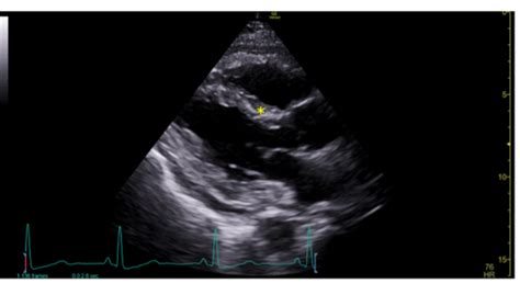 Basics Homework Cornell Hm Pocus