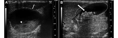 Abdominal Ultrasonography A Gallbladder Contains Echogenic Material Download Scientific