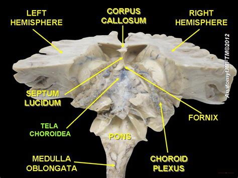 Choroid Plexus Wikiwand