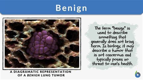 Benign Definition And Examples Biology Online Dictionary
