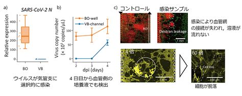 新型コロナウイルスの気管支への感染が血管の構造と機能を低下させることをチップ上で再現 ～血管床を有するmicrophysiological