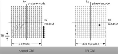 Fmri Bold Basics Flashcards Quizlet