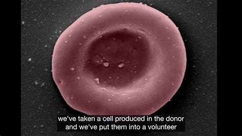 인공혈액 시대 열리나 인공적혈구 사람에 첫 수혈