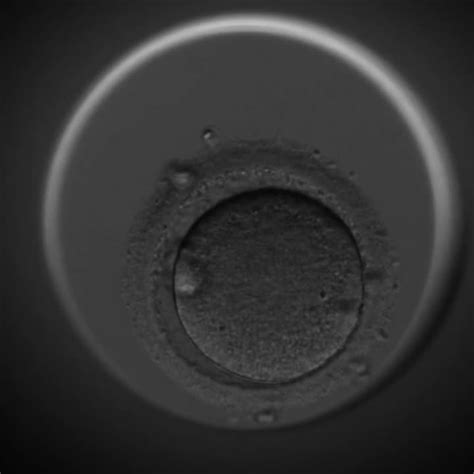 Video Complete Fertility Ltd On Linkedin Take A Look Through The